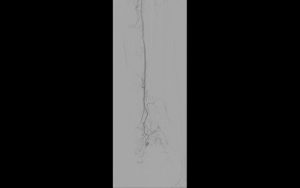 Azurion 7 C20/F20 – LAC Medical