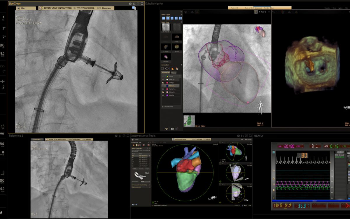 Azurion 7 C20 FlexArm – LAC Medical
