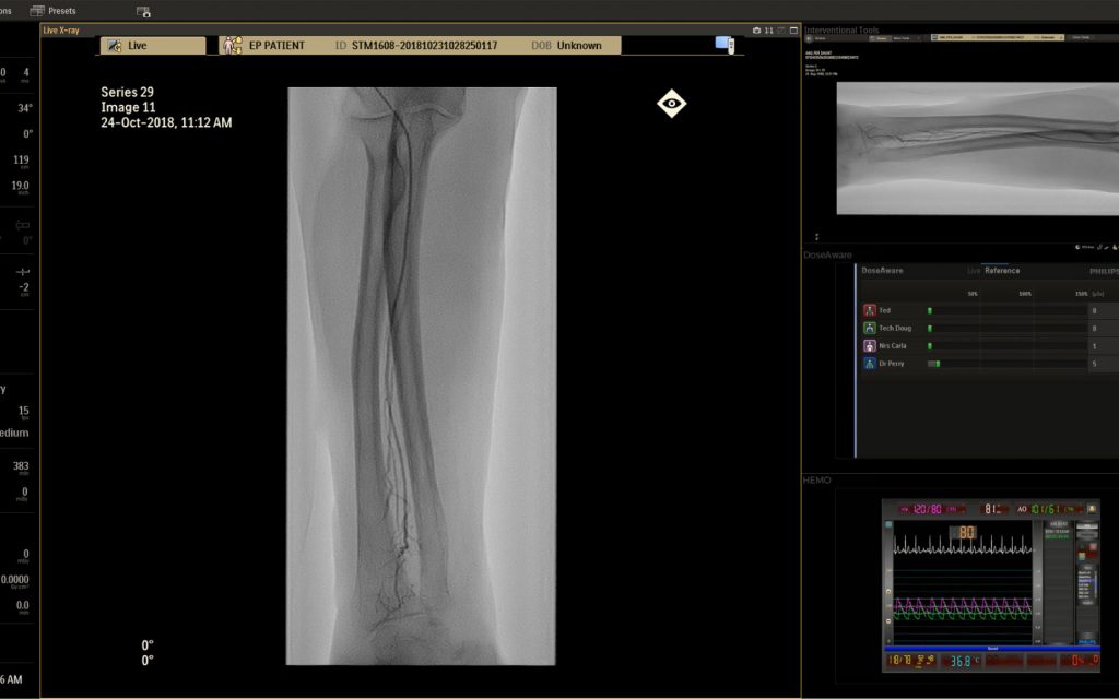 Azurion 7 C20 FlexArm – LAC Medical