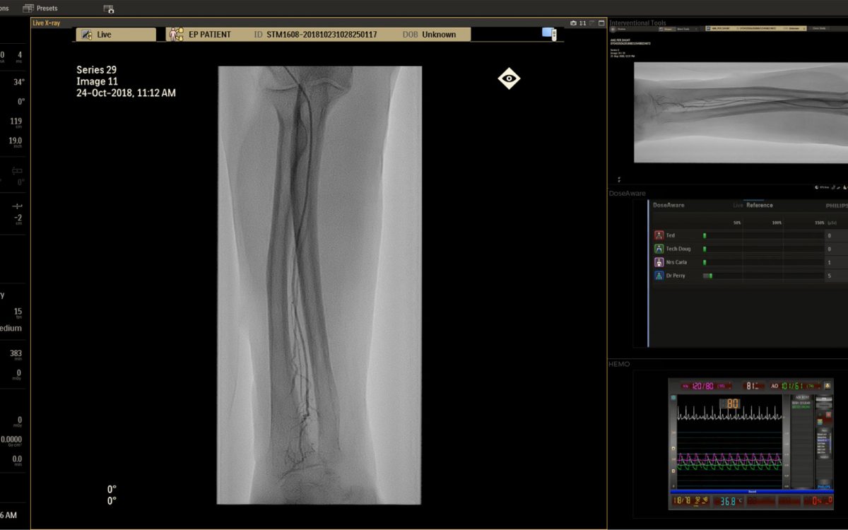 Azurion 7 C20 FlexArm – LAC Medical