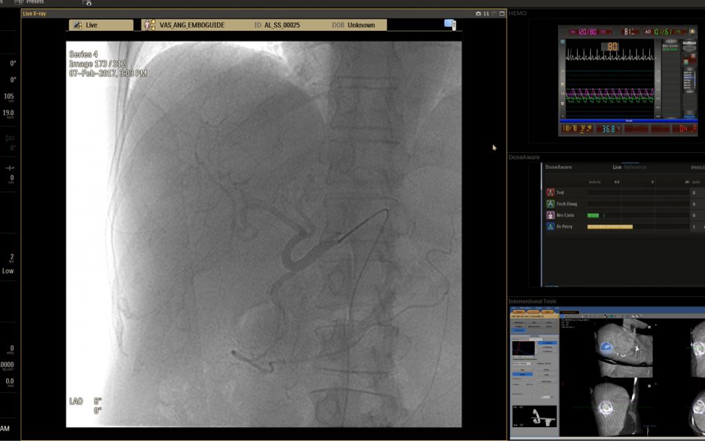 Azurion 7 C20 FlexArm – LAC Medical