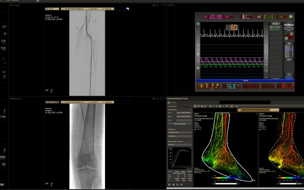 Azurion 7 C20 FlexArm – LAC Medical