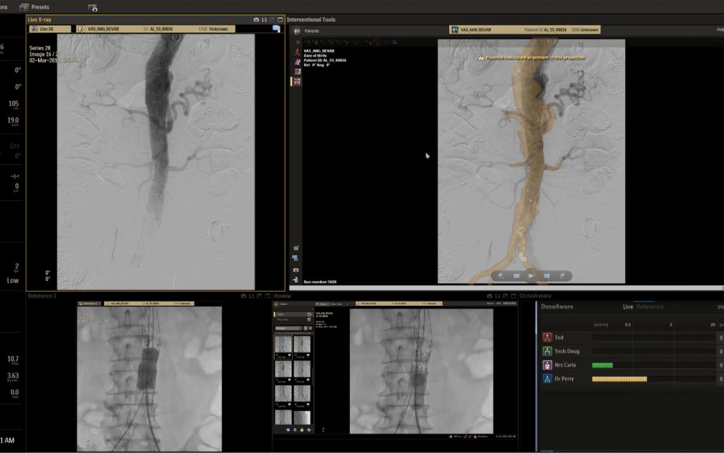 Azurion 7 C20 FlexArm – LAC Medical