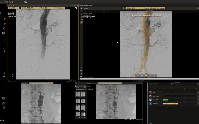 Azurion 7 C20 FlexArm – LAC Medical