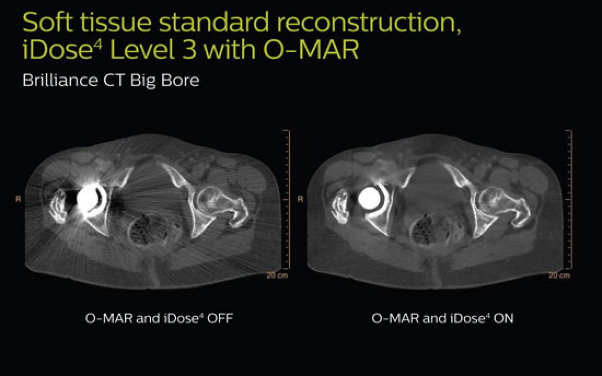 CT Big Bore – LAC Medical